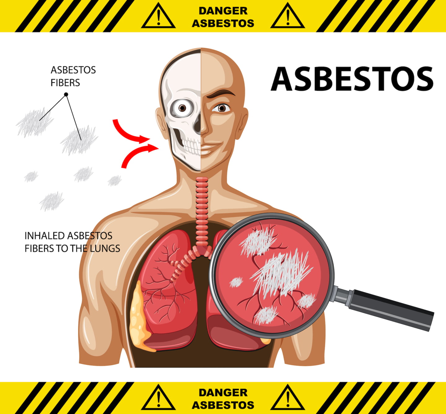 How to choose the right asbestos removal company - Widdington Recycling Ltd
